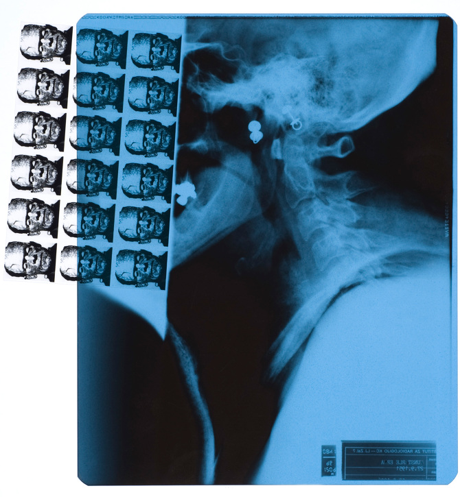 X-Ray Art - Stane Jagodič